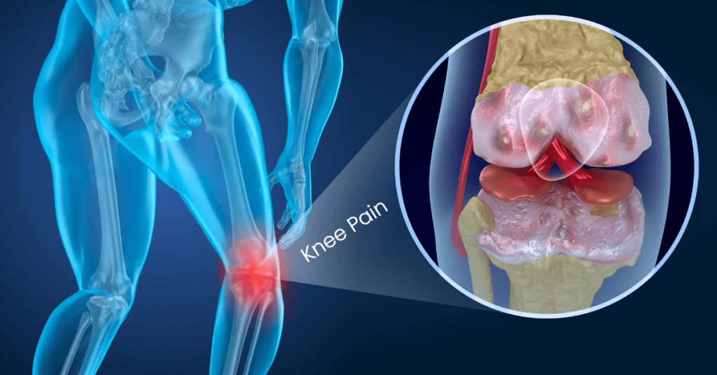 Meet Knee Pain Specialist in Kansas City | Knee Pain Treatment
