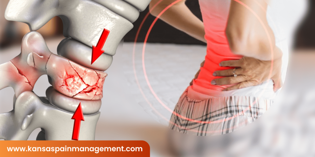 Compression Fractures of the Spine | Kansas Pain Management | Kansas City