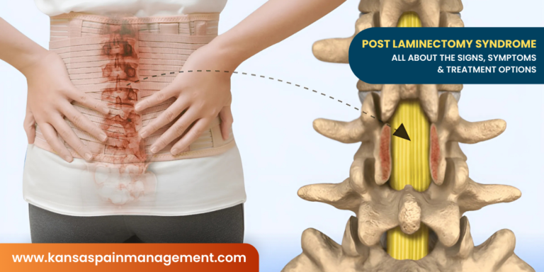 Post Laminectomy Syndrome Treatment in Kansas City