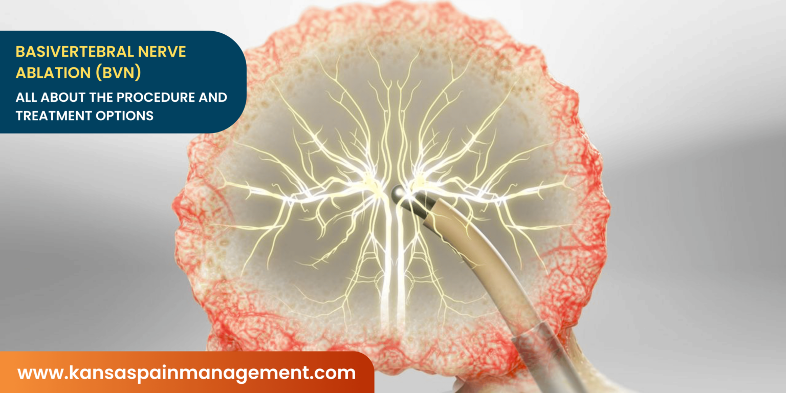 Basivertebral Nerve Ablation (BVN) Treatment in Kansas City MO