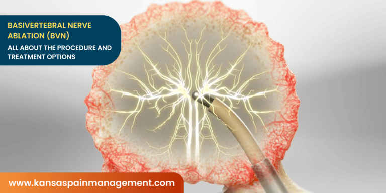 Basivertebral Nerve Ablation (BVN) Treatment in Kansas City MO
