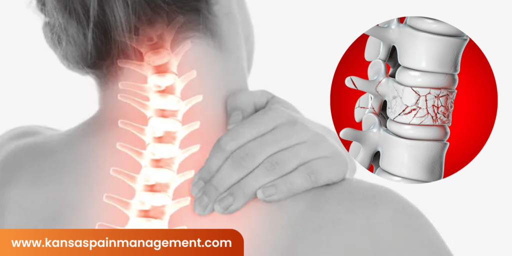 Kyphoplasty Treatment Near Me Kansas City | Kyphoplasty Doctor