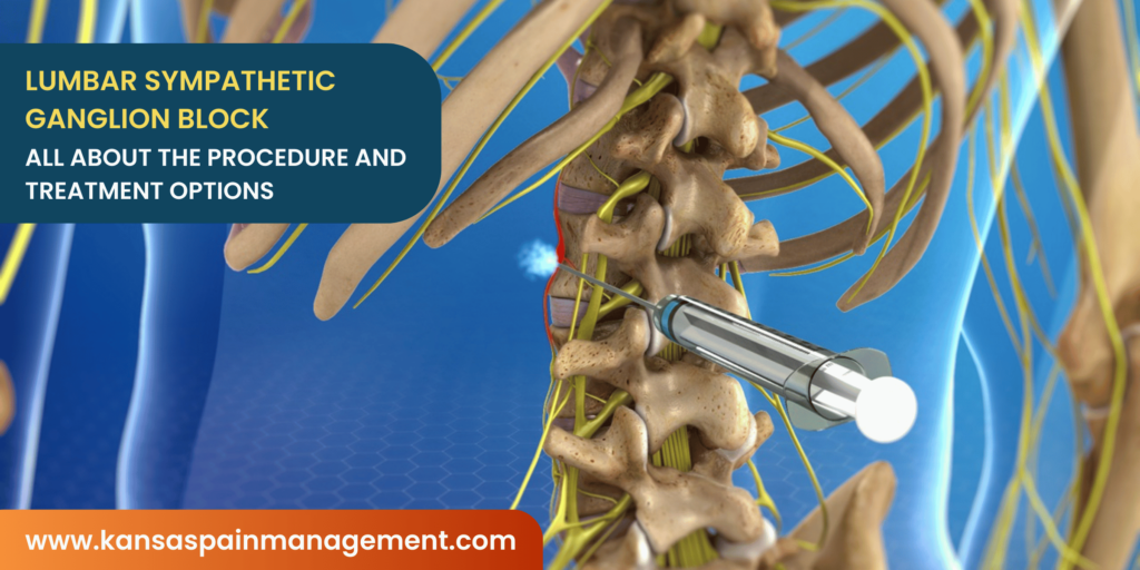 Lumbar Sympathetic Ganglion Block in Kansas City
