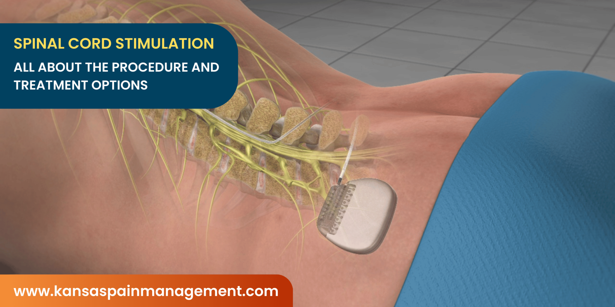 Spinal Cord Stimulation Doctors in Kansas City