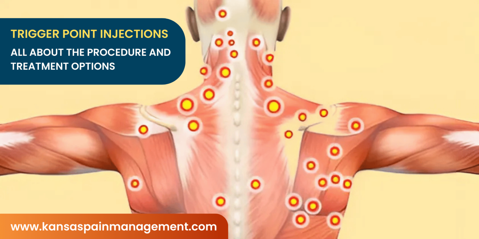 Trigger Point Injections in Kansas City - Kansas Pain Management