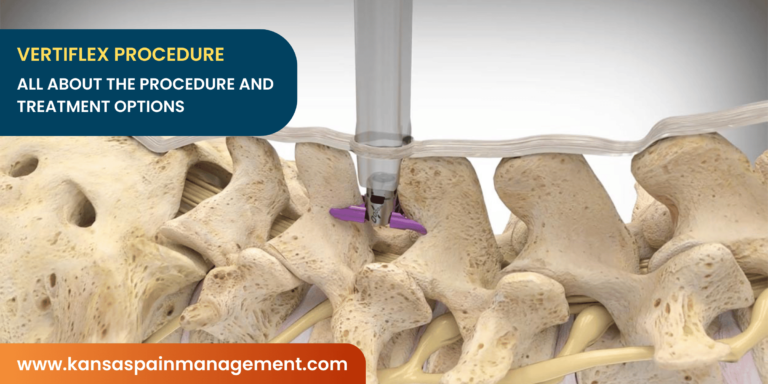 Vertiflex Procedure in Kansas City | Kansas Pain Management