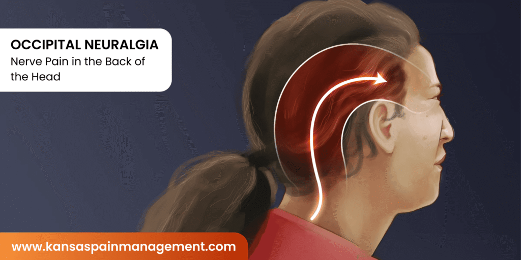 Occipital Neuralgia in Kansas City | Kansas Pain Management