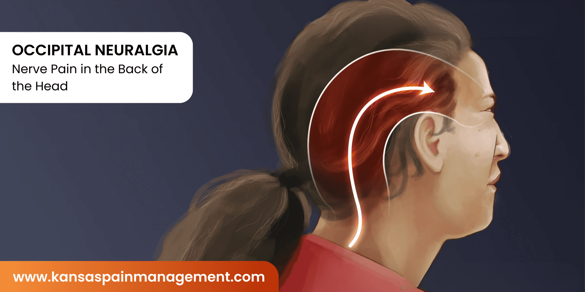 Occipital Neuralgia in Kansas City | Kansas Pain Management
