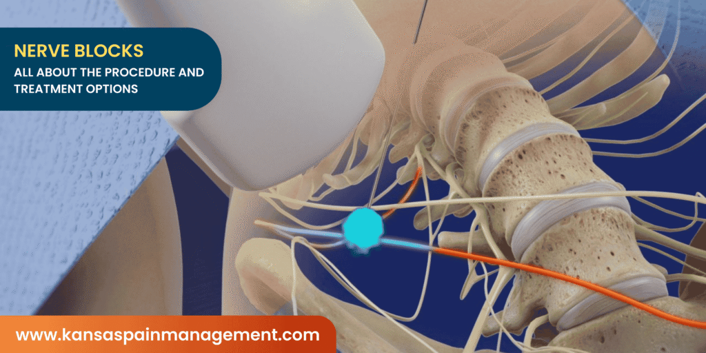 Nerve Blocks for Pain Relief | Kansas Pain Management