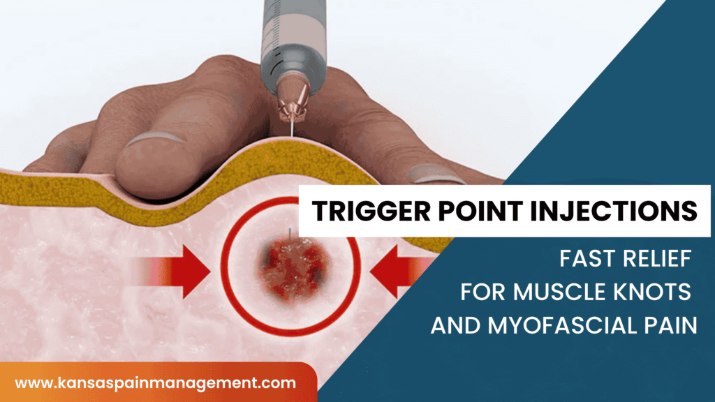 Occipital Nerve Radiofrequency Ablation (RFA)