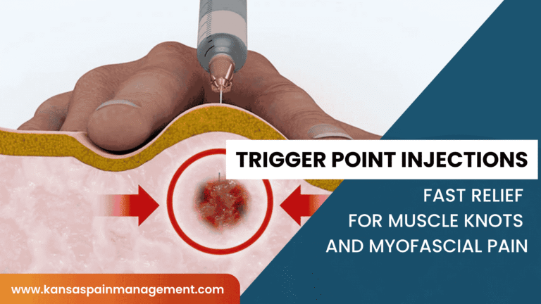 Occipital Nerve Radiofrequency Ablation (RFA)