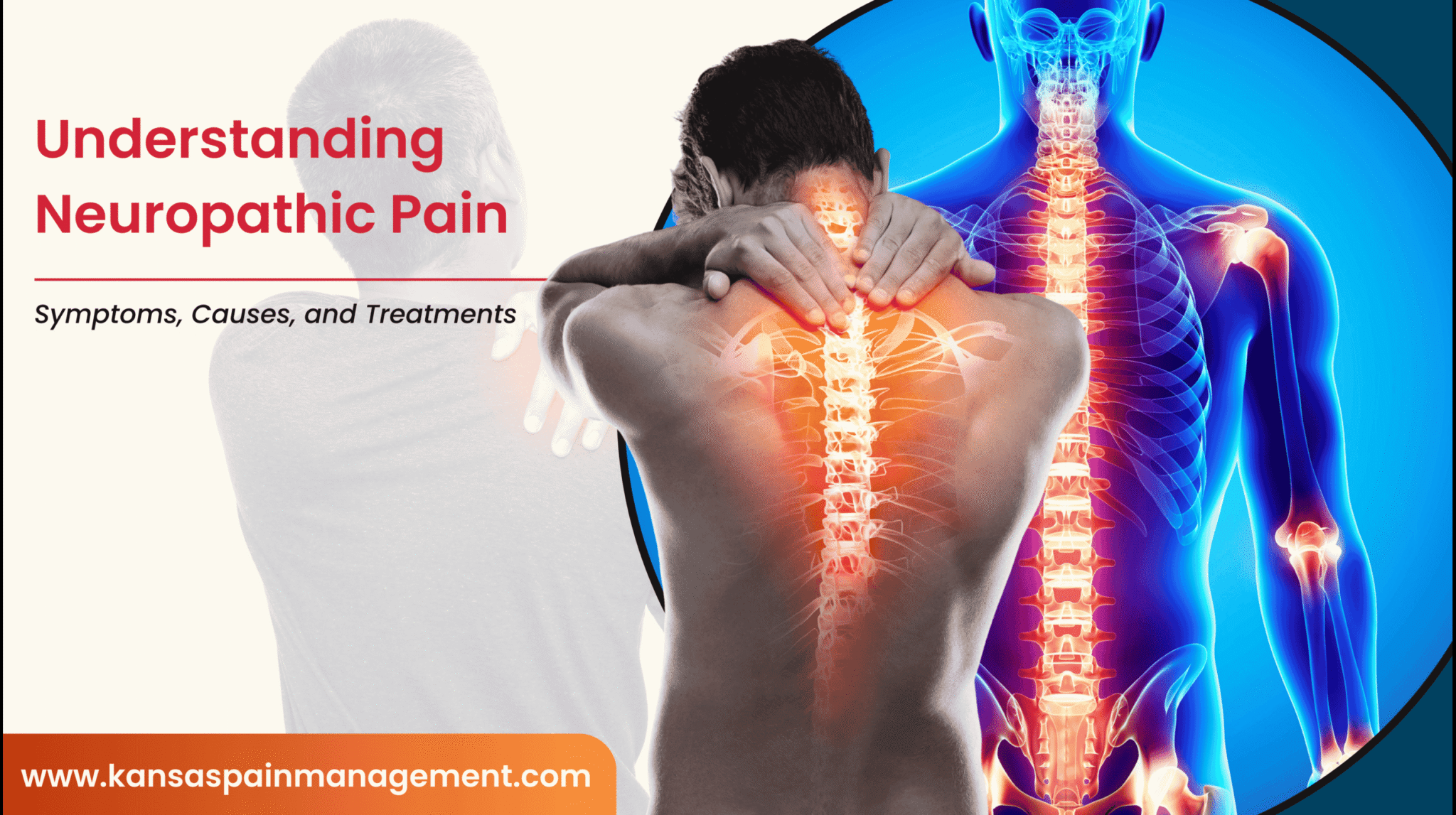 Understanding Neuropathic Pain: Symptoms, Causes, and Treatments