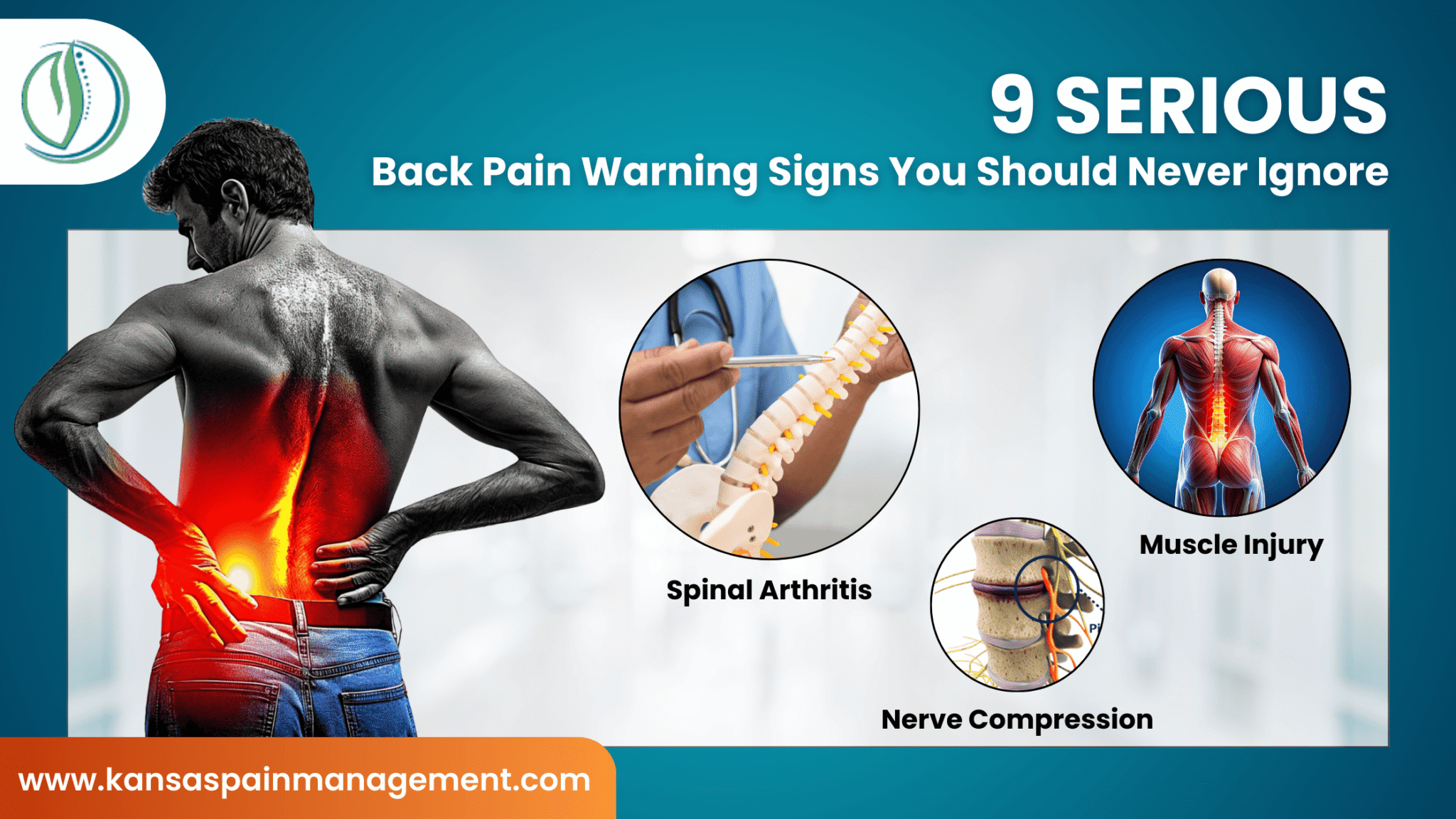 Back Pain Warning Signs You Must Know | Kansas Pain Management