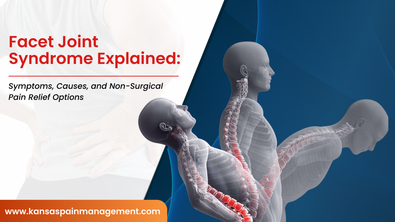 Facet Joint Syndrome Treatment | Non-Surgical Pain Relief